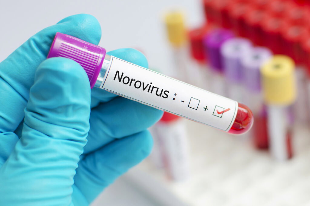 Contagious Virus Sweeps Spain « Euro Weekly News