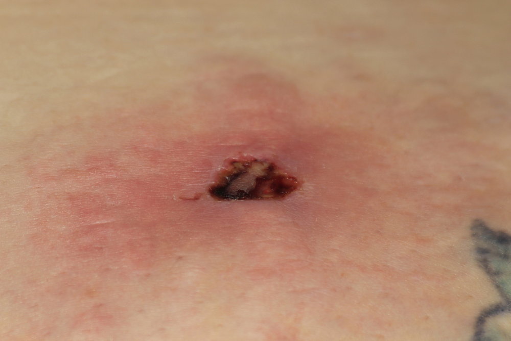 Mediterranean Recluse Spider Scare in Spain « Euro Weekly News