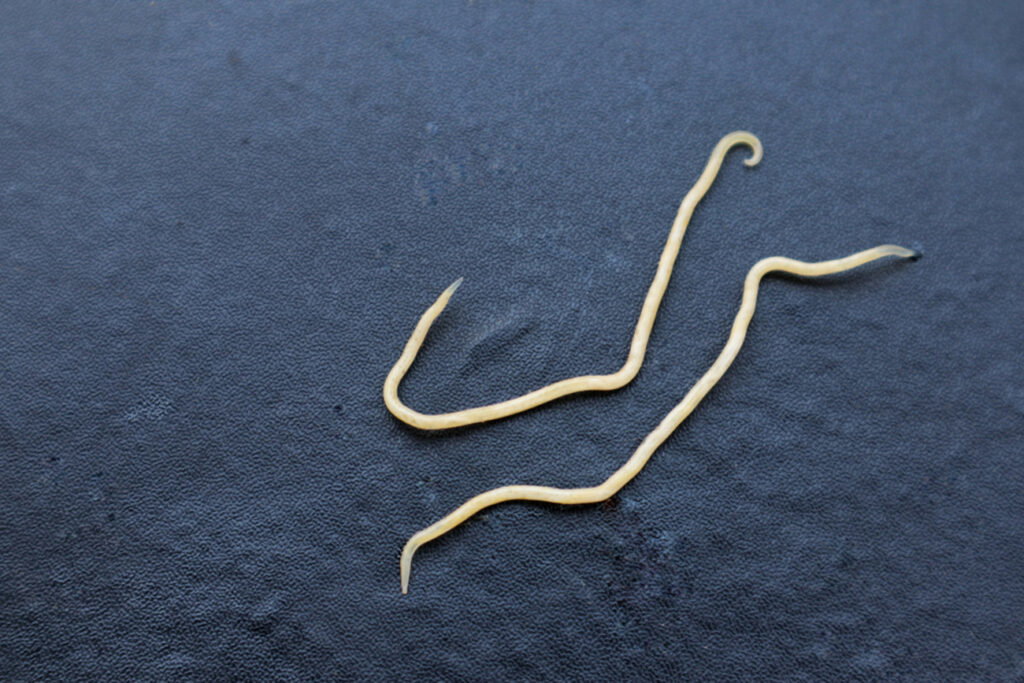 Popular parasite cleanses « Euro Weekly News