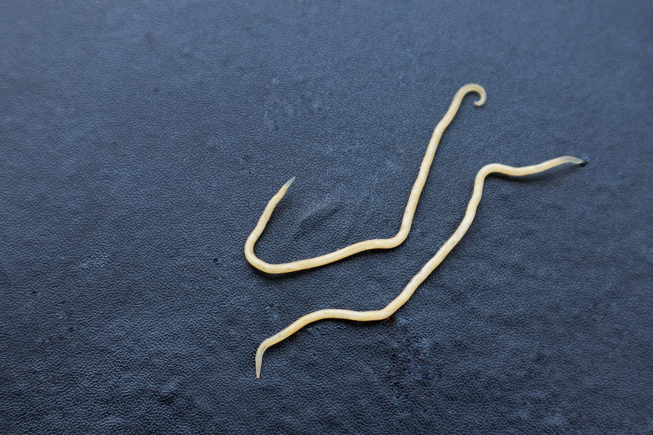 Popular parasite cleanses « Euro Weekly News