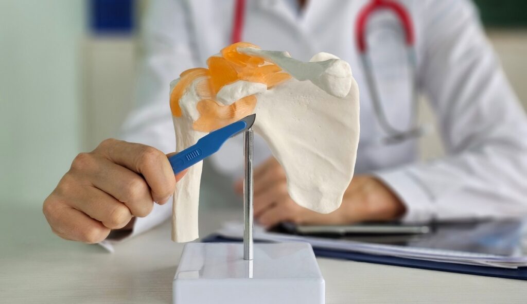 Breakthrough shoulder surgery in Estepona « Euro Weekly News